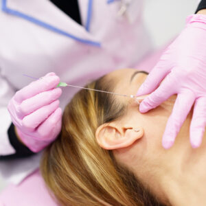 Thread Lift Gone Wrong: How To Fix The Problem