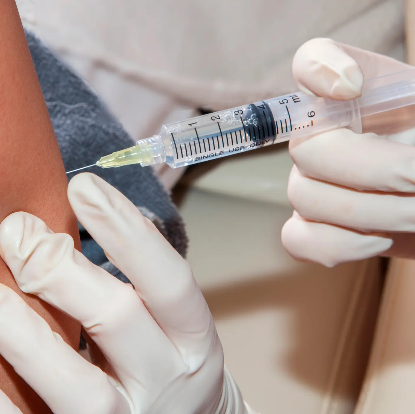 Mesotherapy injections near me | Scottsdale, AZ