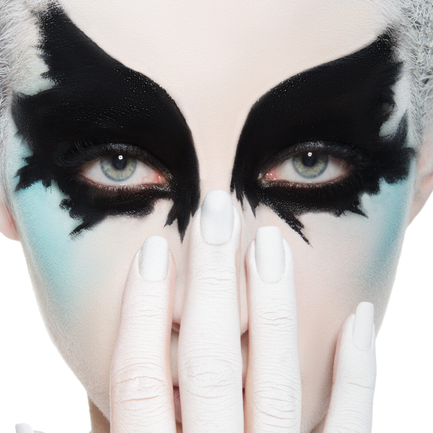 Bellafill Treatment in Scottsdale AZ