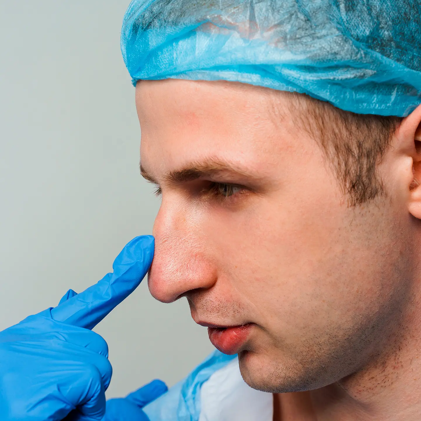 Non surgical nose job with PDO threads in Phoenix, AZ