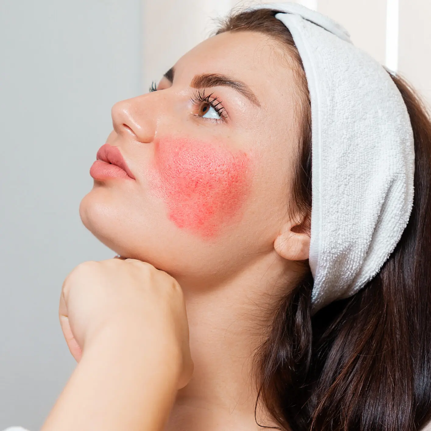 Chronic Skin Conditions - DesertBloom skincare