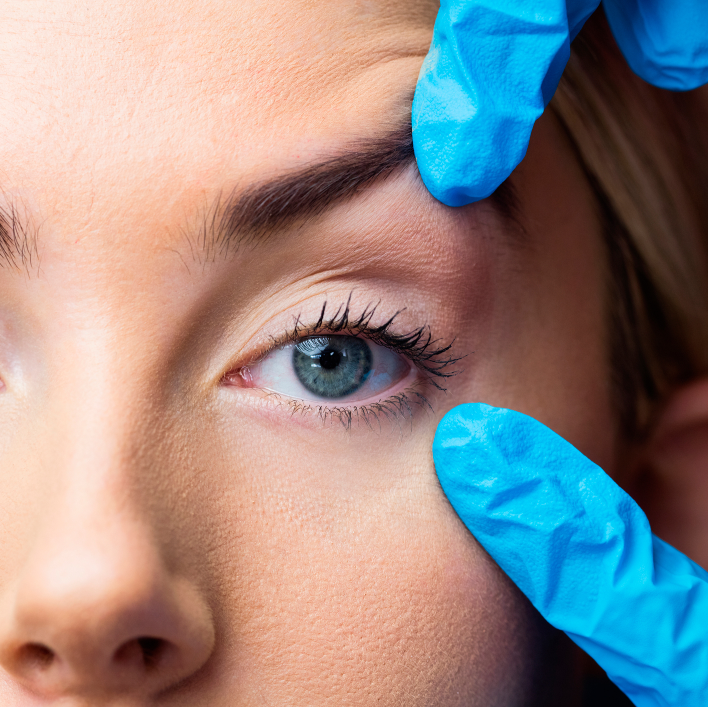 Botox treatment in Scottsdale, AZ