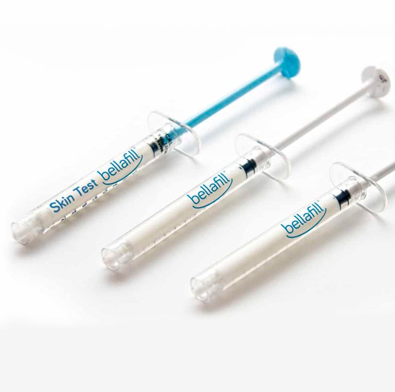 Bellafill Treatment in Scottsdale AZ