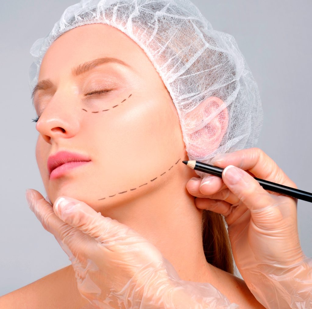 PDO Thread Lift | Lifting Threads in Scottsdale, AZ