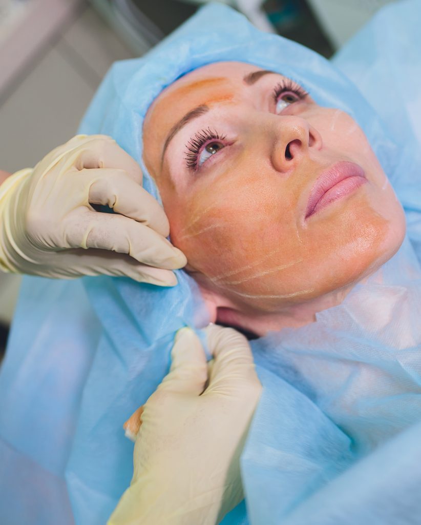 PDO threads vs. dermal fillers